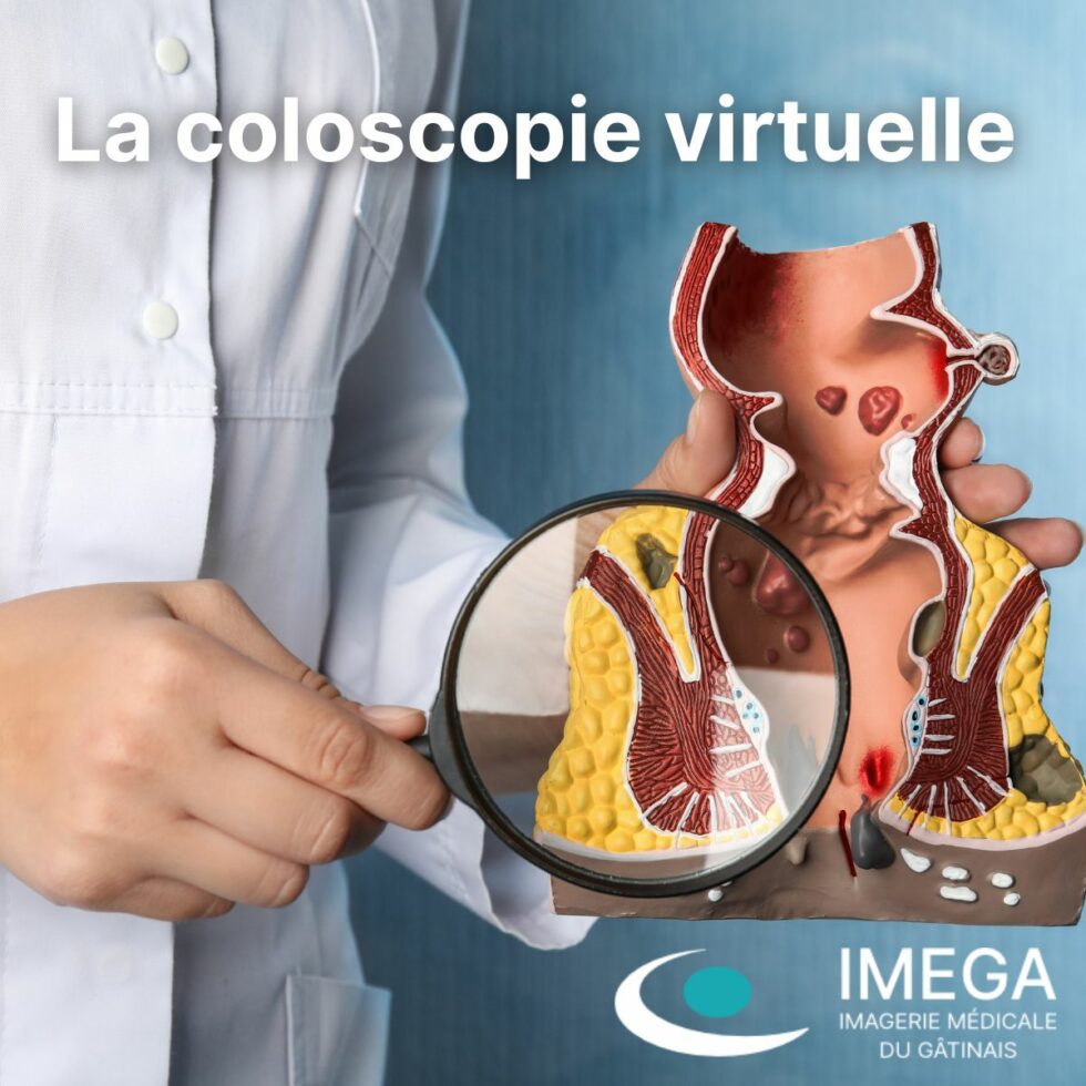 Coloscopie virtuelle : Tout ce que vous devez savoir sur cet examen d’imagerie médicale | Centre ...
