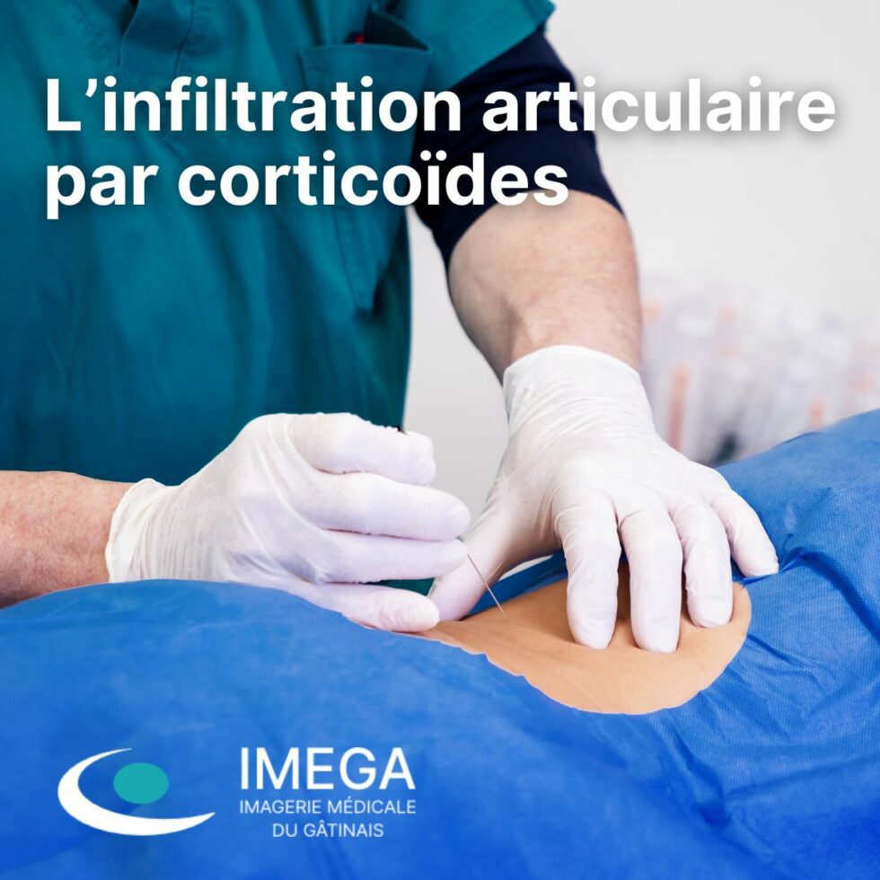 L'infiltration articulaire par corticoïdes : soulager l'inflammation ...